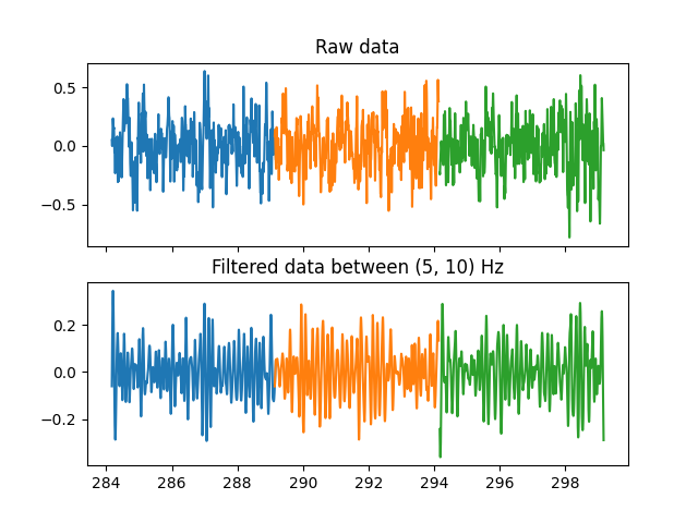 Streamreceiver Real Time Buffer Filtered With A Causal Filter Bsl
